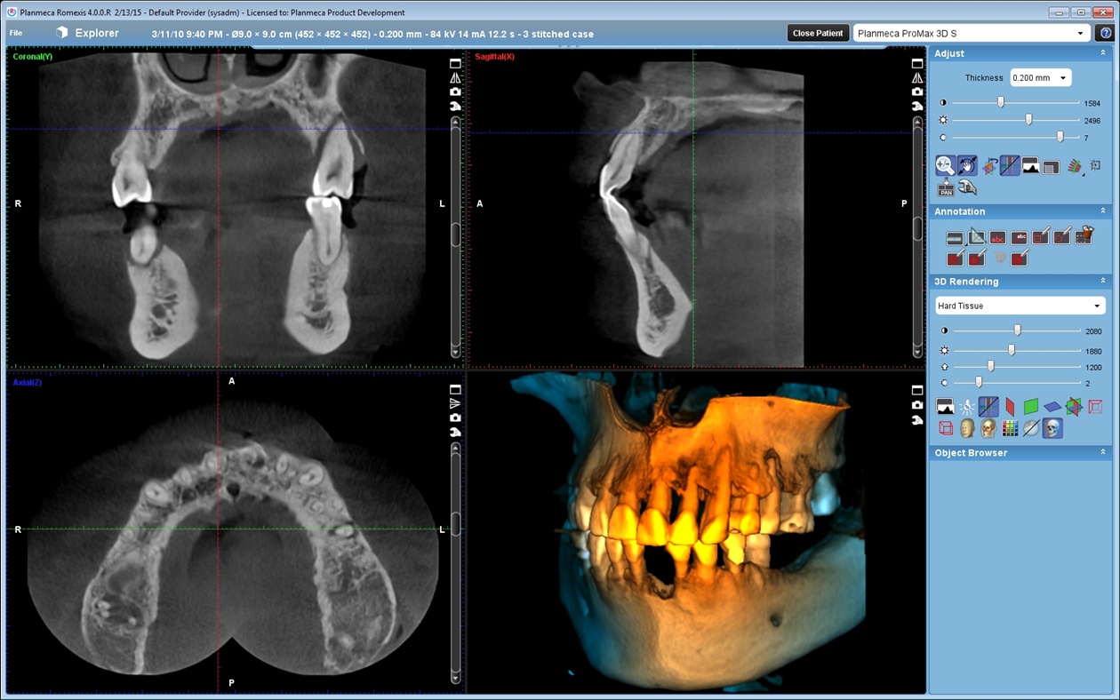 Dimax-Ray: Cone beam computed tomography